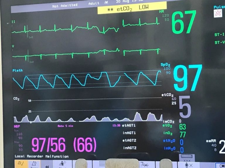 A Systematic Approach to Capnography Waveforms - EMS Airway