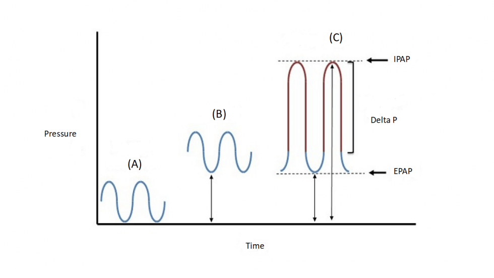 Why Not BiPAP? - EMS Airway