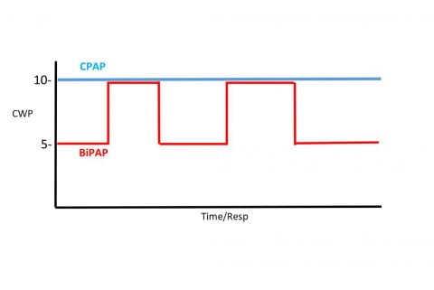 Essentials of BiPAP - EMS Airway