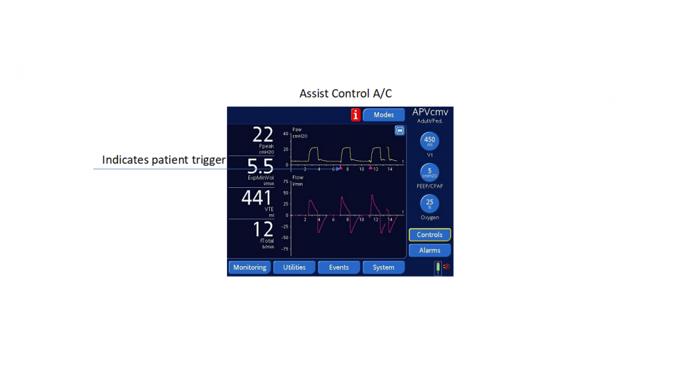 Demystifying Ventilator Modes: It’s Not That Complicated! - EMS Airway