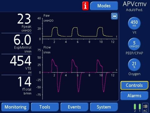 Demystifying Ventilator Modes: It’s Not That Complicated! Part 2 - EMS ...