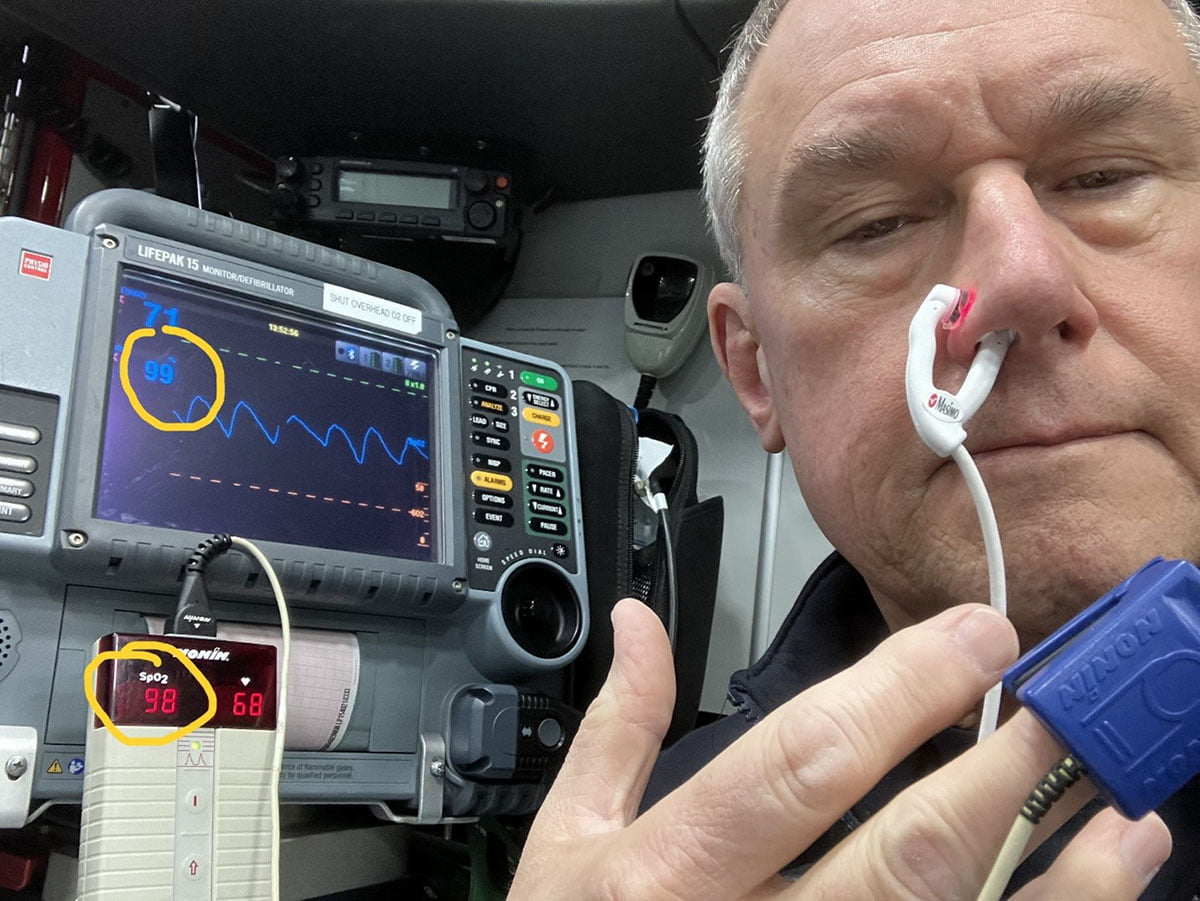 When You Really Need a SpO2 and Your Monitor Won’t Cooperate - EMS Airway